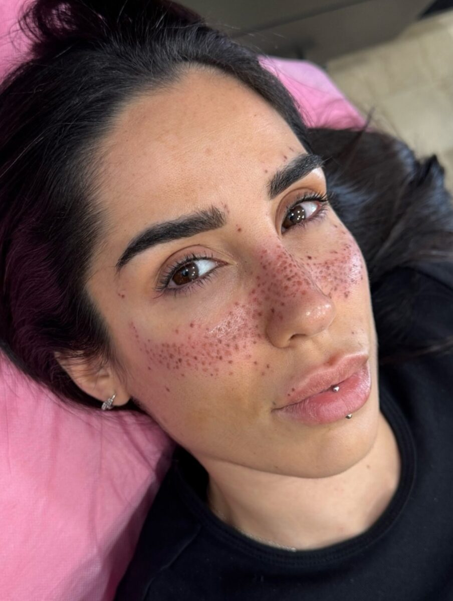 25 Cute Freckle Tattoo Ideas for a Natural Look & Subtle Beauty